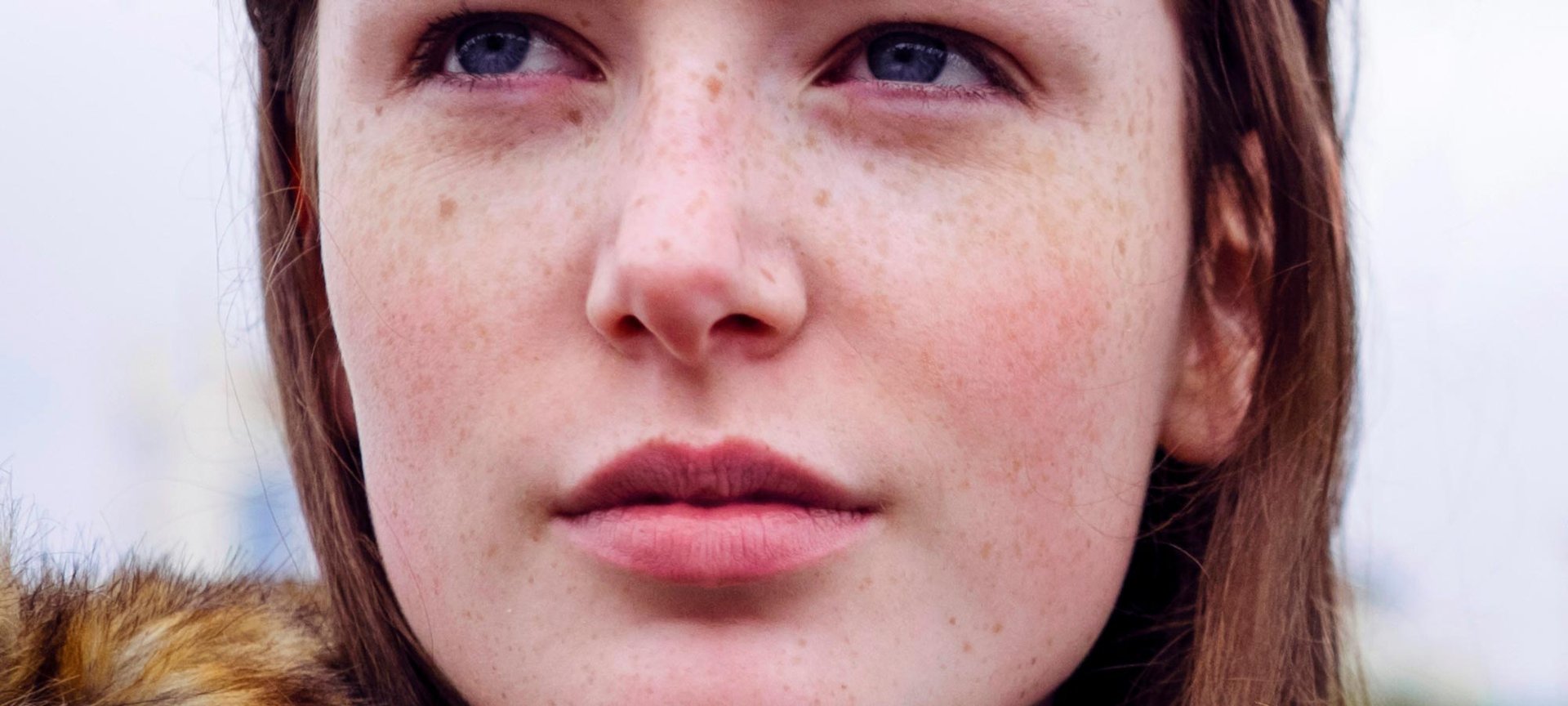 Rojeces en la piel: ¿cómo eliminarlas en piel sensible? L'Oréal Paris