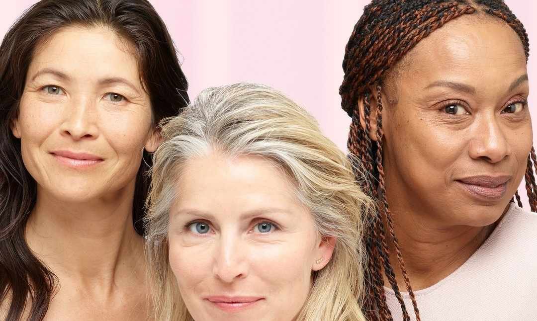 Manchas marrones en la cara: diferentes clases y tratamientos| L'Oréal ...