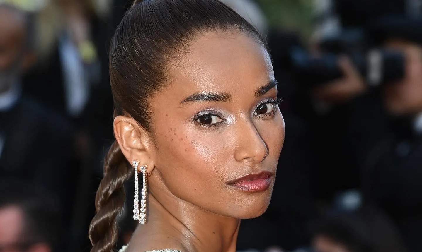 Manchas marrones en la cara: diferentes clases y tratamientos| L'Oréal ...